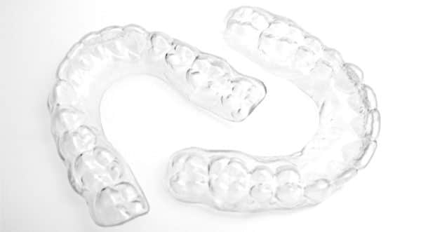Removable Retainers | Bovenizer & Baker Orthodontics
